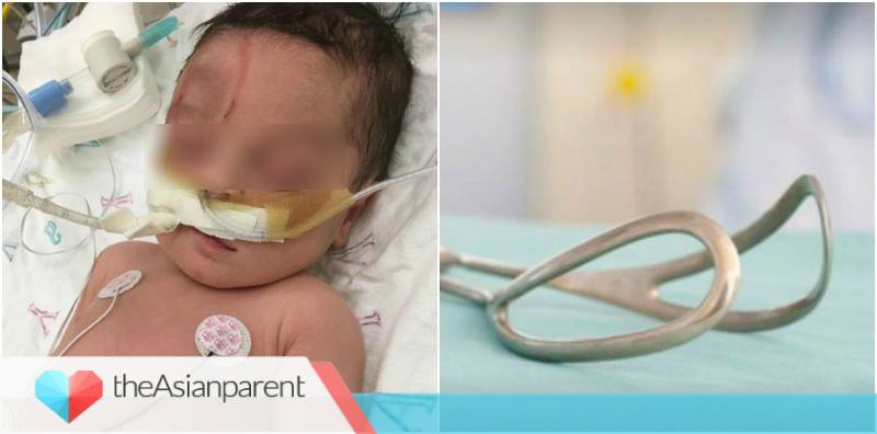 Forceps Delivery Risks To Baby: Baby's Head Internally Decapitated