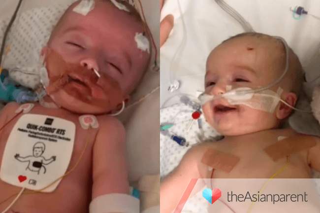 Baby Wakes From 5 Day Coma But Requires Further $150,000 Surgery