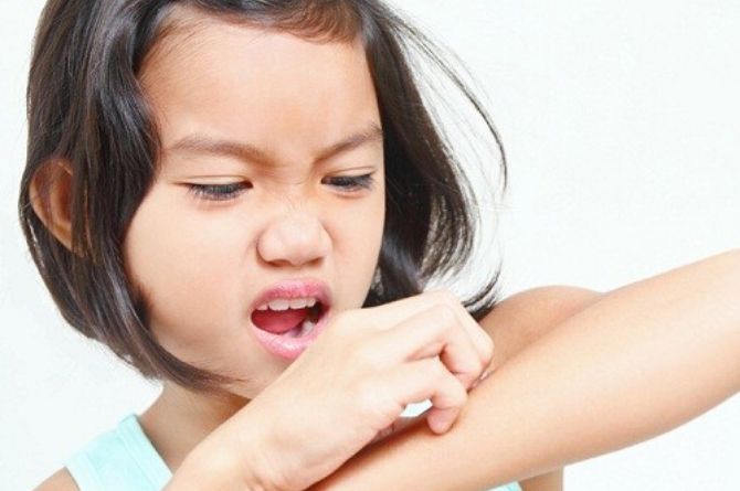Eczema In Kids: Everything Parents Need To Know