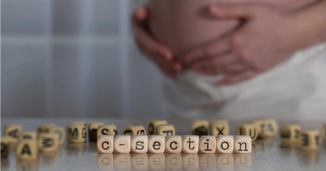 C-Section Complications: Doctor’s Advice On Complications & Prevention