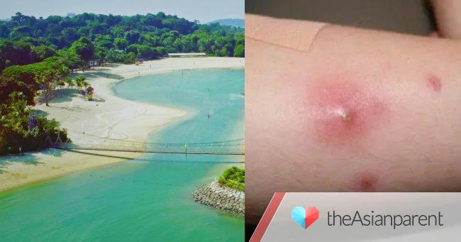 Four People Suffer Skin Irritation At Sentosa Beaches, NEA Issue Advisory