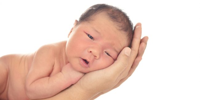 6 Things You Need to Know About Your Baby's Skin Colour