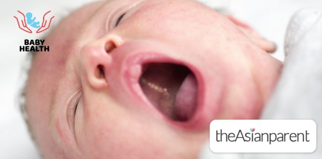 Epstein pearls in infants: what causes and how to treat?