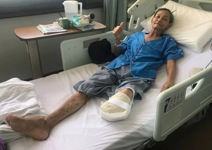 Diabetic Local Actor Duan Weiming Amputates Left Calf