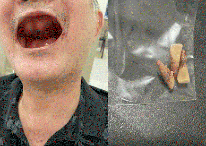 Uncle Loses Teeth After Brawl With Couple Over Baby Stroller in ...