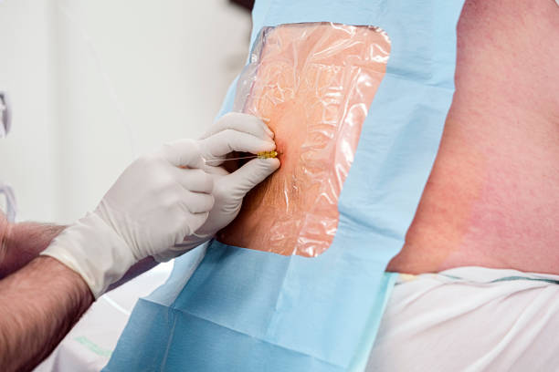 Epidural Pros and Cons: Making Informed Choices for Pain Relief