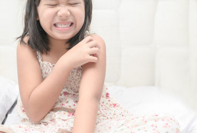 Does my child just have Dry Skin or is it Eczema?