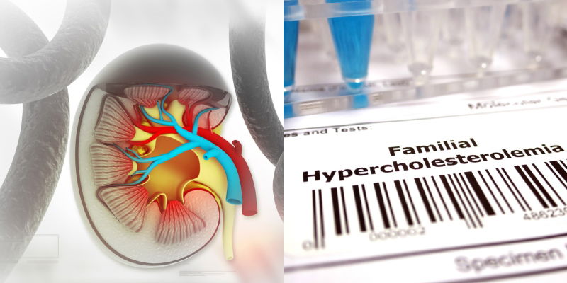 KKH Children's Lipid Centre: Singapore's First Dedicated Clinic for ...