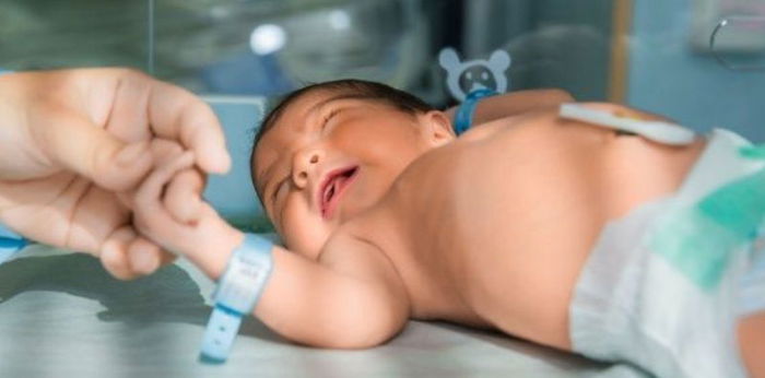 Pierre Robin Syndrome: Symptoms, Causes, and Treatment