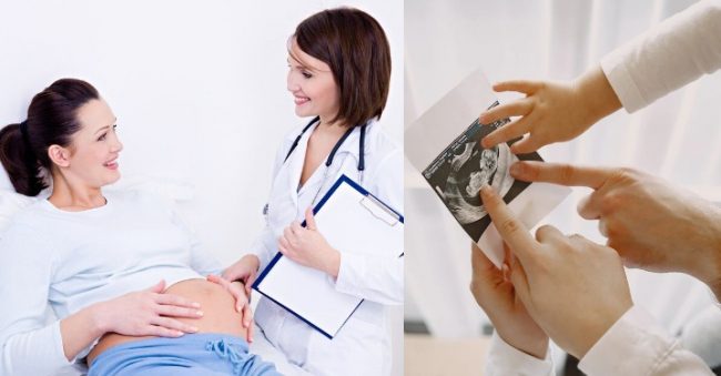 Why Can USG HPL Change? Turns Out These Are 6 Causes, Mom!