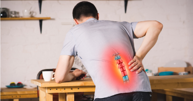 Understanding Sciatica: Symptoms, Causes, Treatment, and Prevention