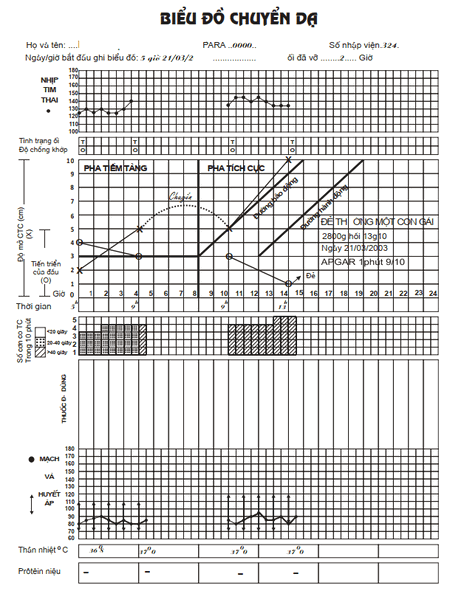 Biểu đồ chuyển dạ giúp ích gì cho quá trình "vượt cạn"?
