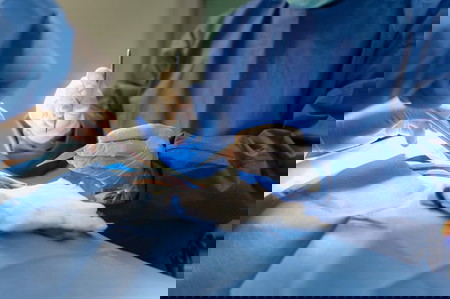 Video prosedur vasektomi, metode kontrasepsi permanen bagi lelaki