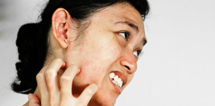 Alergi Dingin: Gejala, Penyebab, dan Cara Mengatasinya