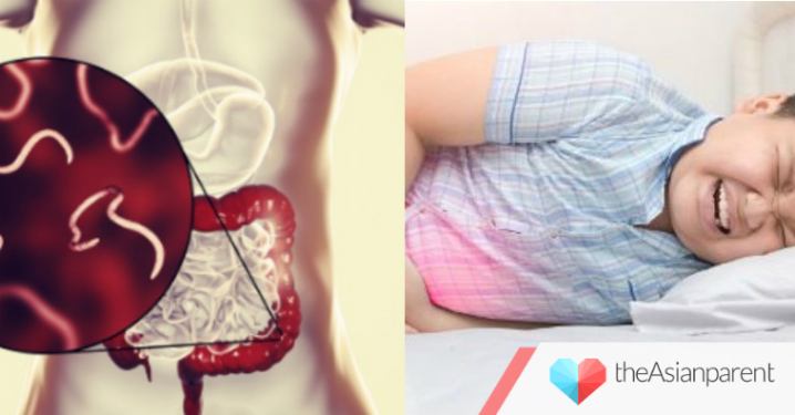 Obat Cacing yang Aman dan Efektif Menurut Dokter Anak