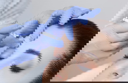 Efek samping botox yang sering dirasakan, wajib tahu sebelum mencoba!