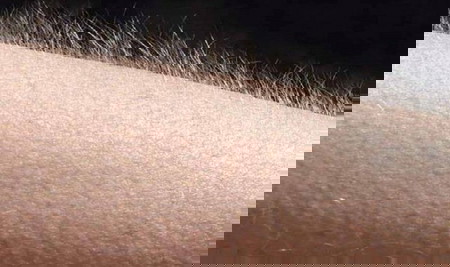 Penyebab merinding menurut ilmiah, sudahkah Anda mengetahuinya?