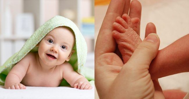 Kulit bayi kering, ini penyebab dan cara mengatasinya!