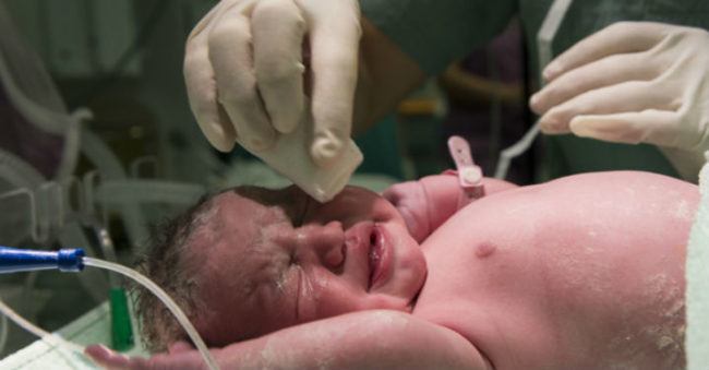 Penanganan BBLR dan pencegahannya, wajib lakukan 8 cara ini!