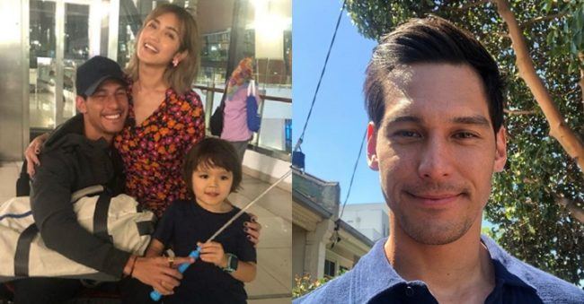 Richard Kyle jalani operasi cangkok kulit: "Aneh, badanku sudah berubah,"