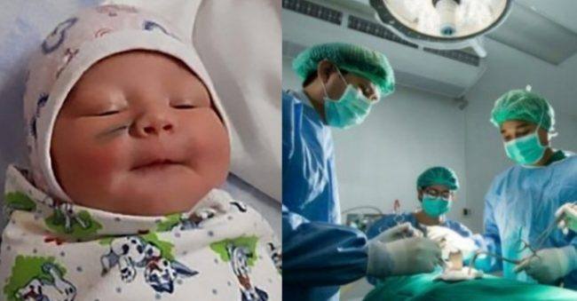 Akibat kelalaian dokter, wajah bayi alami luka sayatan saat caesar