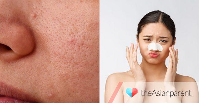 16 Cara Mengecilkan Pori Pori Wajah, Sederhana & Gunakan Bahan Alami