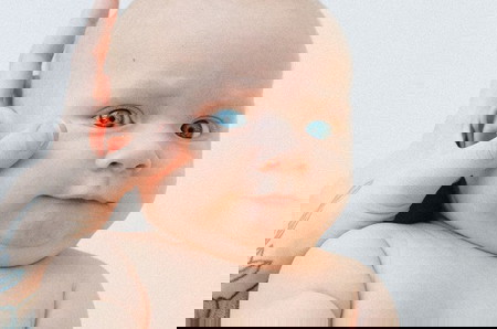 10 Penyebab Bibir Kering dan Pecah-Pecah pada Bayi