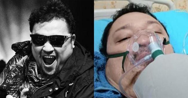 Mantan Gitaris Band Gigi, Aria Baron Meninggal Dunia Karena COVID-19