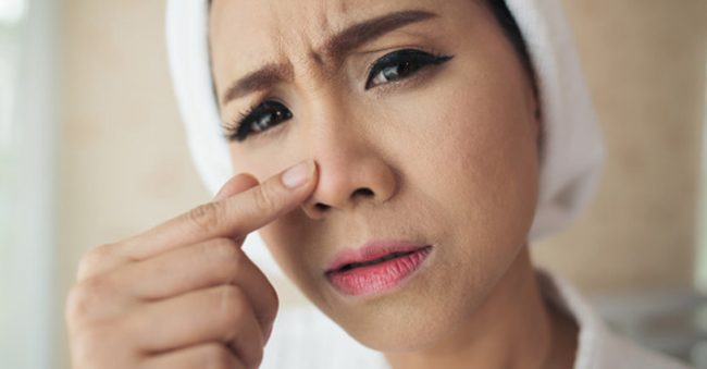 6 Cara Menghilangkan Komedo Hitam yang Ganggu Penampilan
