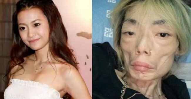Wu Zhiheng, Mantan Supermodel yang Kini Lumpuh dan Ditinggal Suami