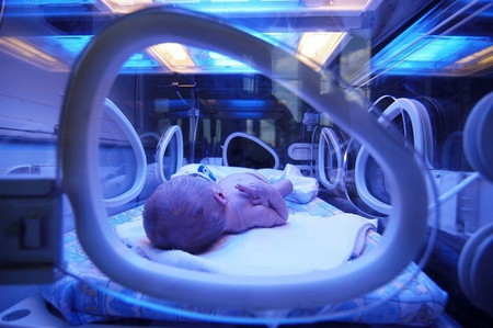 Mengenal NICU, Ruangan Perawatan Intensif Bayi Baru Lahir