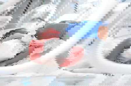 Mengenal NICU, Ruangan Perawatan Intensif Bayi Baru Lahir