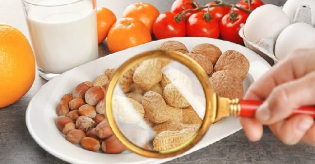 Penyebab, Gejala dan Cara Mengatasi Gejala Alergi Makanan