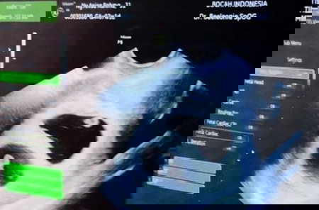 Anisa Rahma Hamil Anak Kembar Setelah Menanti 4 Tahun Lamanya