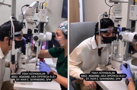 Kelopak Mata Bengkak Karena Kalazion, Rey Mbayang Operasi Mata