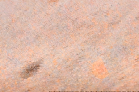 Xeroderma Pigmentosum: Gejala, Penyebab, dan Penanganan