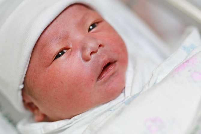 How to Determine Gestational Age of Newborn Baby with Ballard Score