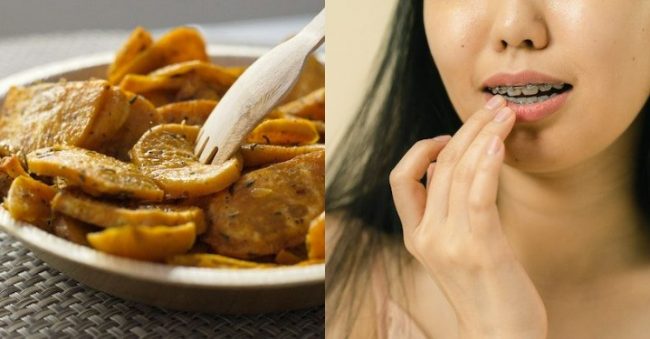 15 Makanan untuk Pengguna Behel, Enak dan Mudah Dikunyah!