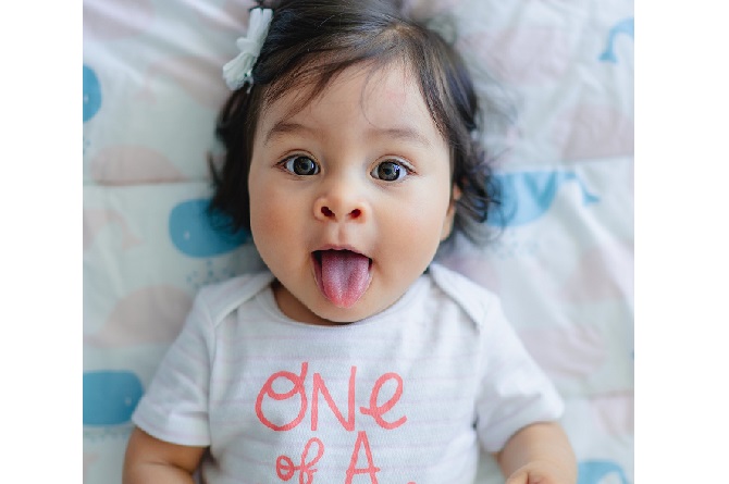 Macroglossia: Causes, Symptoms, Treatment, Complications