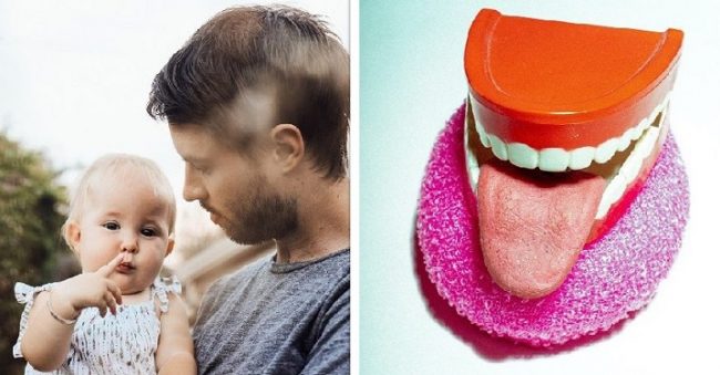 Macroglossia: Penyebab, Gejala, Penanganan, Komplikasi