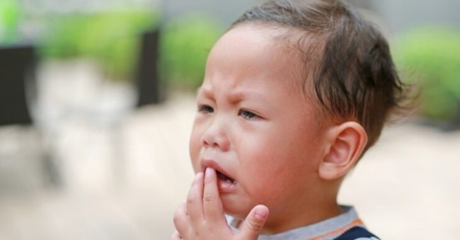 Viral Exanthem: Definisi, Gejala, Penyebab, dan Penanganan