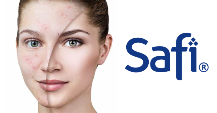 10 Produk Safi untuk Jerawat, Harga Terjangkau di Bawah 200 Ribu!