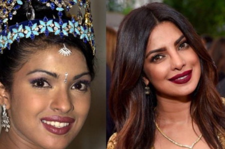 11 Artis India yang Operasi Plastik agar Tampil Lebih Cantik