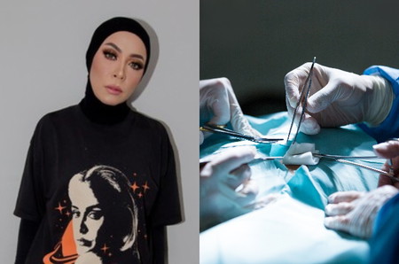 Berapa Biaya Operasi Bariatrik yang Dilakukan Melly Goeslaw agar Kurus?