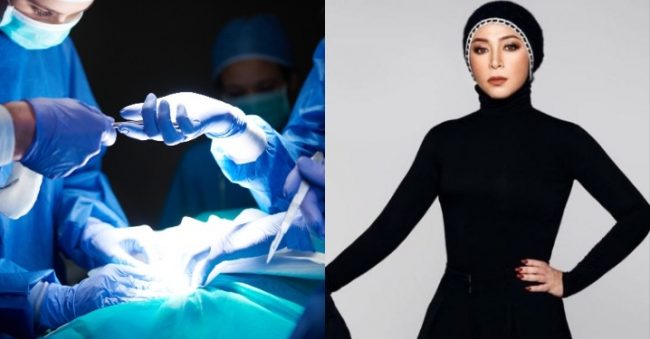 Berapa Biaya Operasi Bariatrik yang Dilakukan Melly Goeslaw agar Kurus?