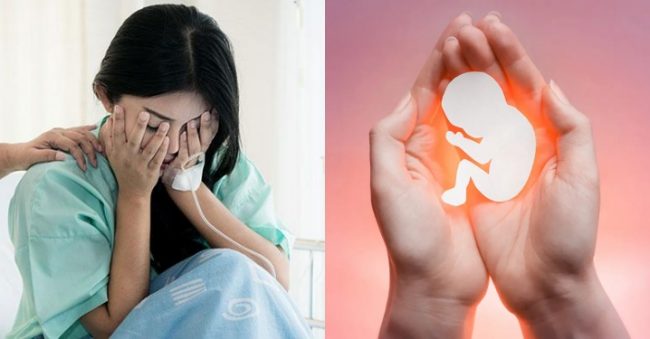Kronologi Kasus Kepala Bayi Tertinggal di Rahim Ibu Asal Bangkalan