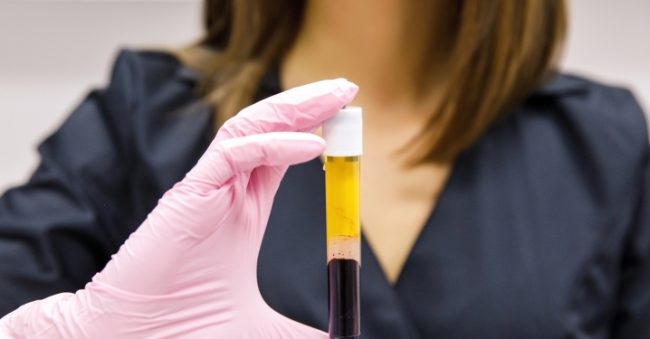 Jumlah Trombosit Normal Anak Sehat dan Saat Terkena DBD