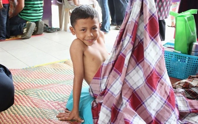 Berkhatan - Apa Yang Ibu Bapa Perlu Tahu, Semuanya Ada Di Sini!