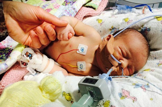 Born Without Lung, Toddler’s Heart Stapled To Her Ribcage To Stop It ...