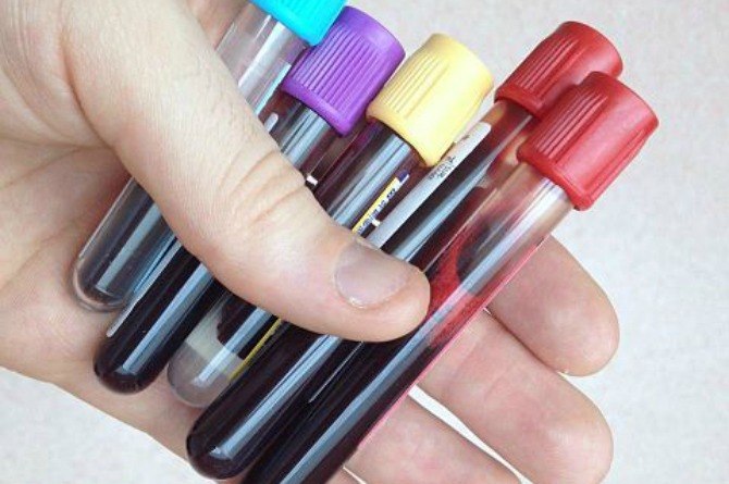 Blood Type Health: Your Blood Type Puts You At Risk Of These Illnesses